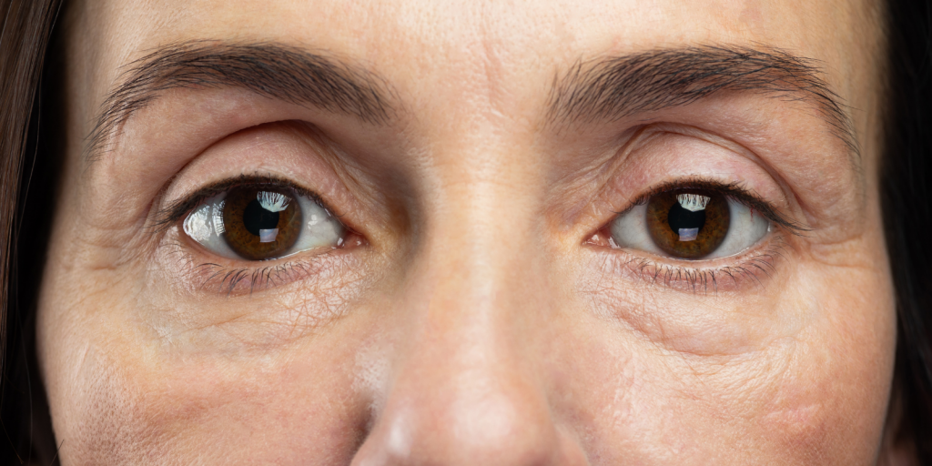 How to relieve tired eyes | Ageing Skin | Blog | Cosmetier Dunstable